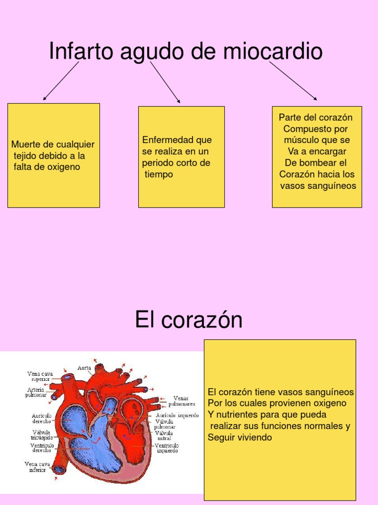 Infarto Agudo de Miocardio Adultos 2-3 | PDF | Infarto de miocardio ...