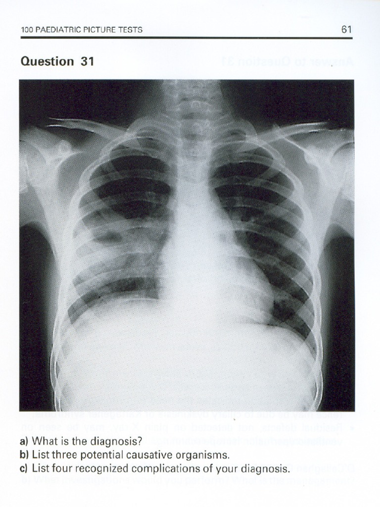 100 Paediatrics Pictures Tests OSCE PDF | PDF