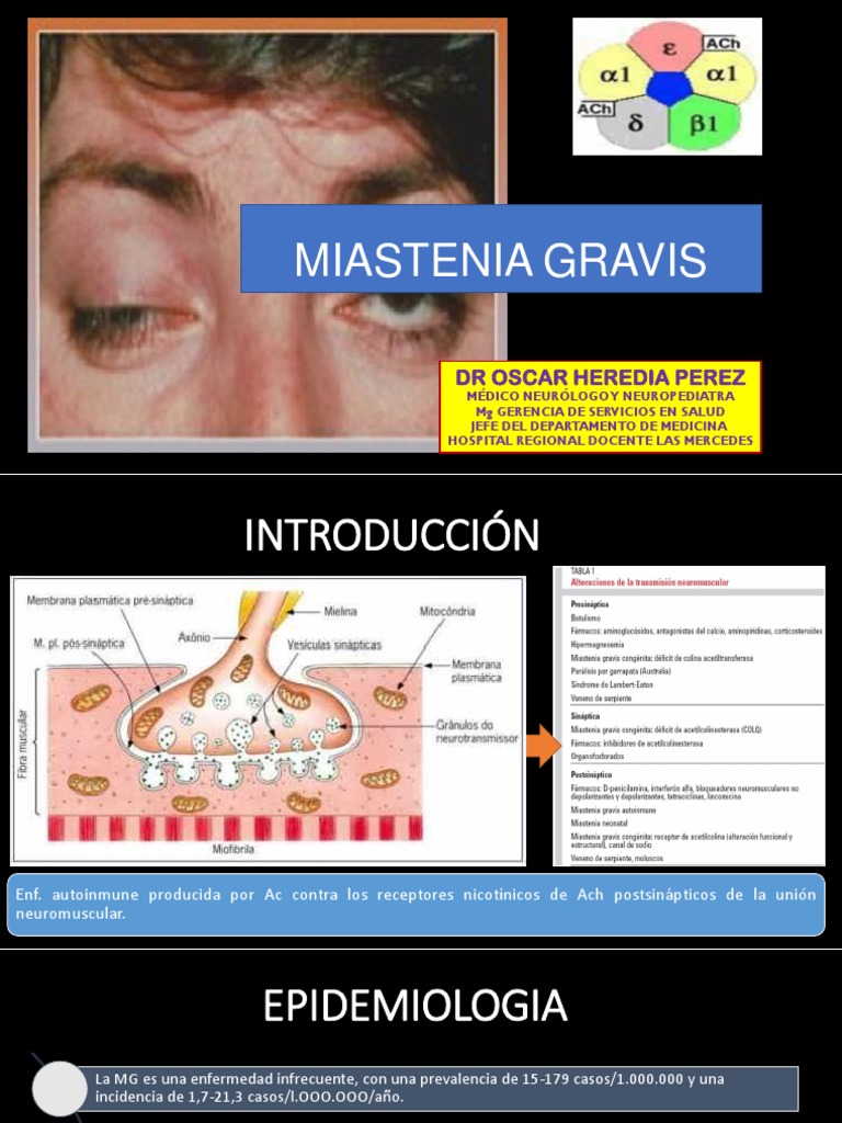 Miastenia Gravis Clase - Exposición | PDF | Electromiografia | Inmunología