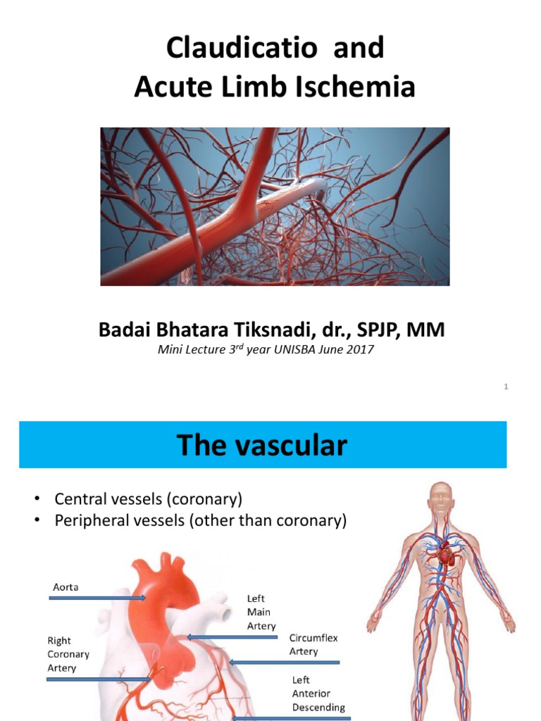 Acute Limb Ischemia and Claudication Unisba 2017 | Ischemia ...