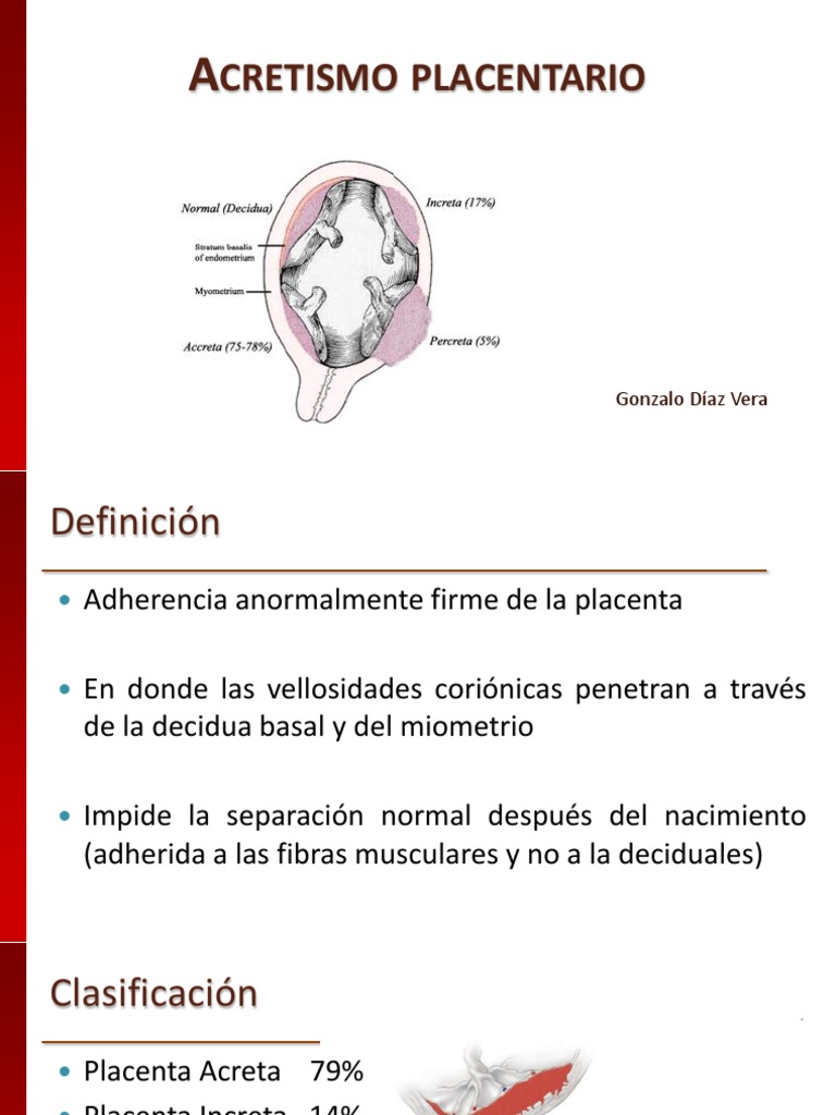 ACRETISMO PLACENTARIO | Placenta | Parto