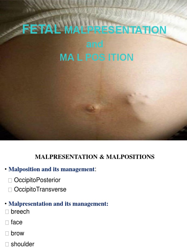 Malpositions and Malpresentations Final | PDF | Caesarean Section | Childbirth