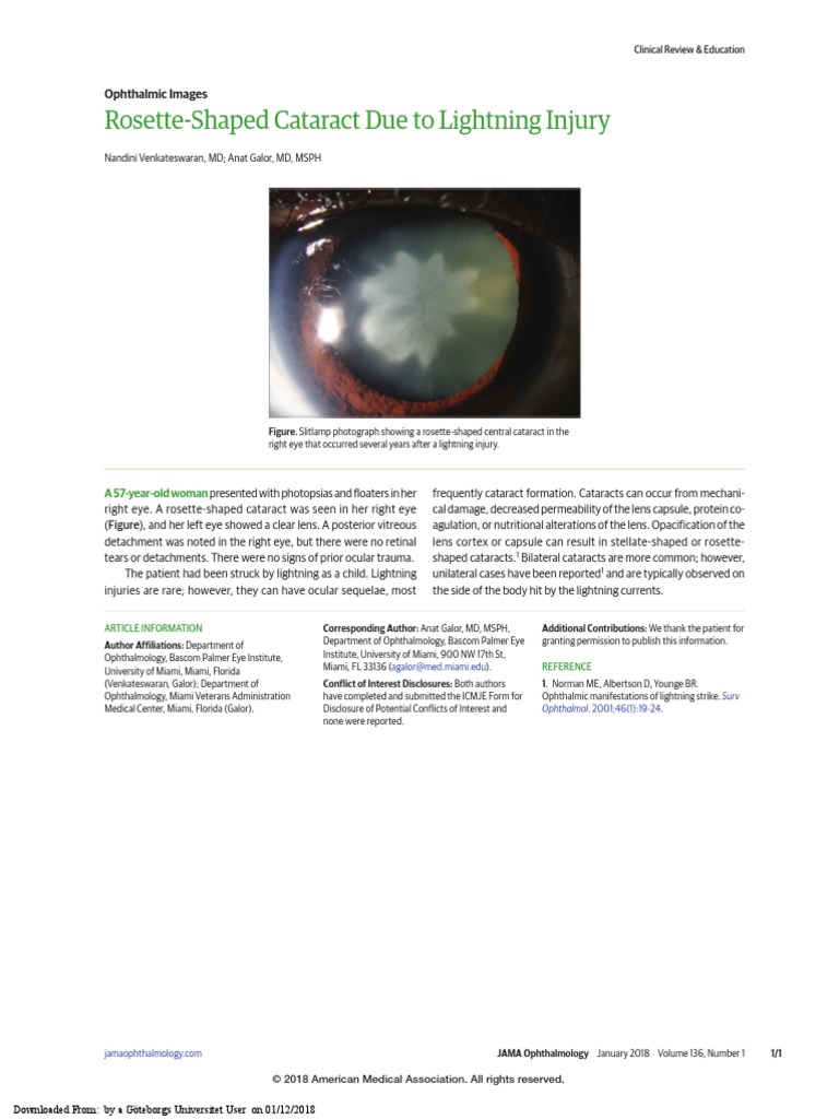 Rosette-Shaped Cataract Due To Lightning Injury: Ophthalmic Images ...