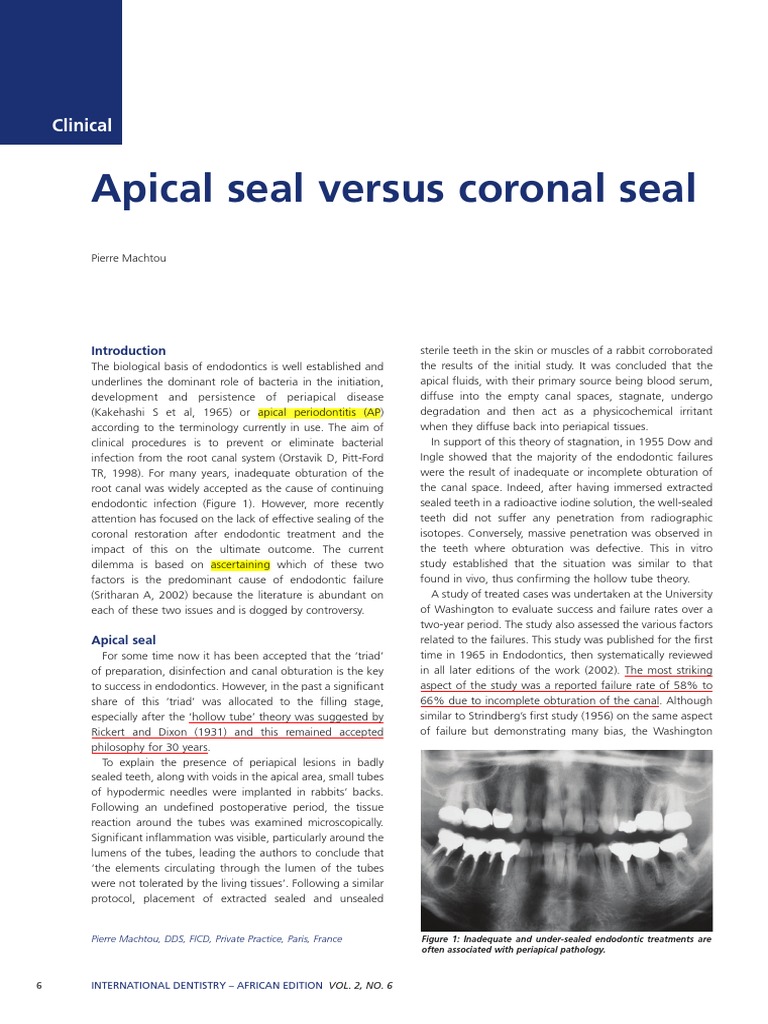 Apical vs Coronal Seal in Endodontics | PDF | Mouth | Dentistry