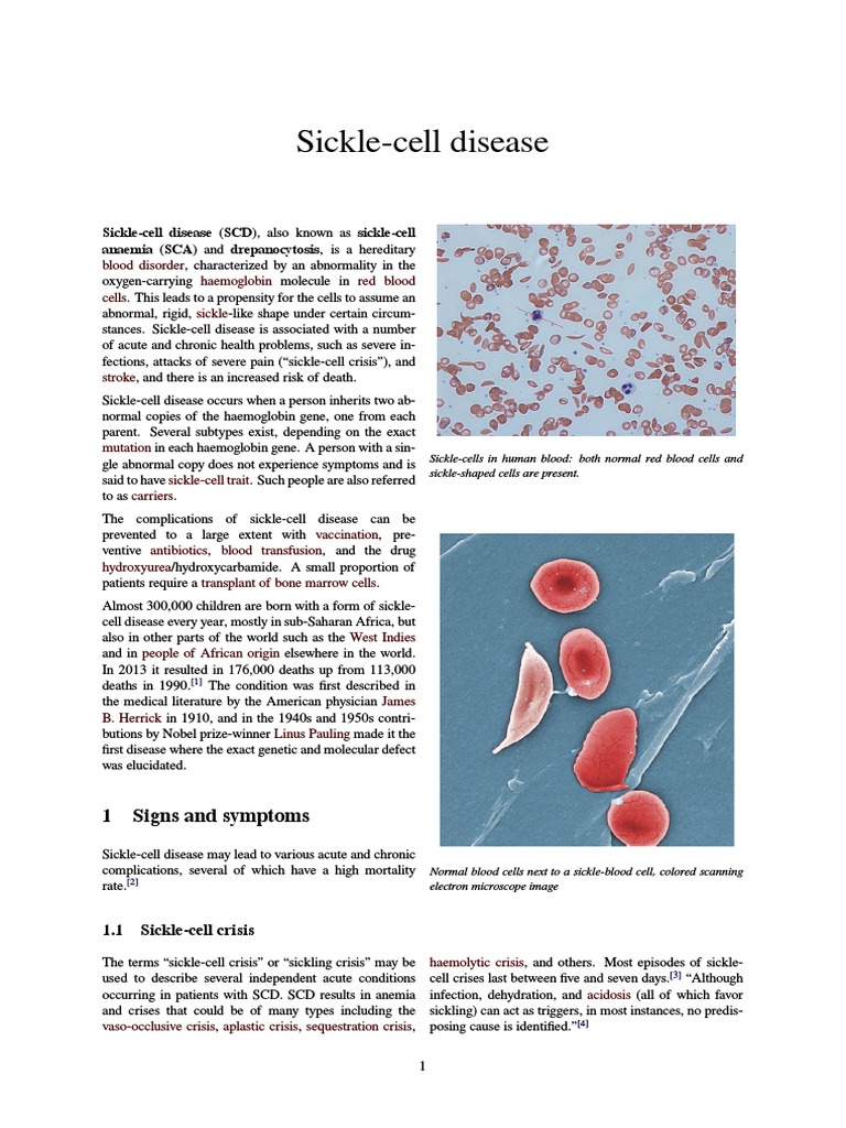 Sickle Cell Disease | PDF | Diseases And Disorders | Medicine