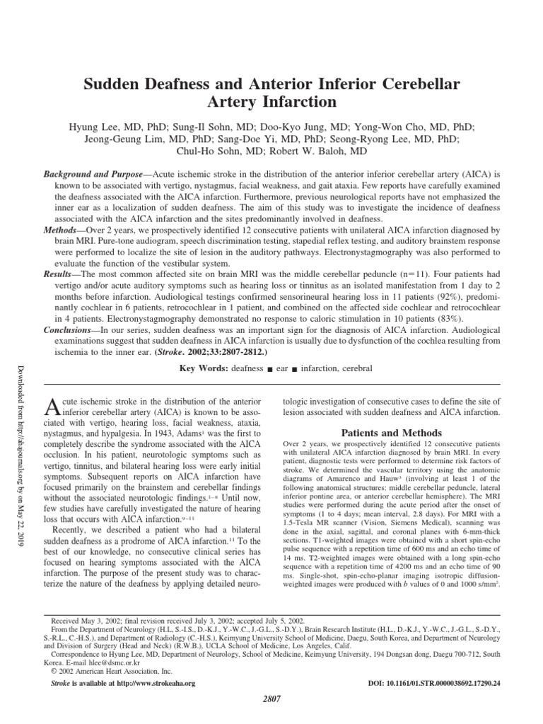 AICA Infarct | PDF | Vertigo | Hearing Loss