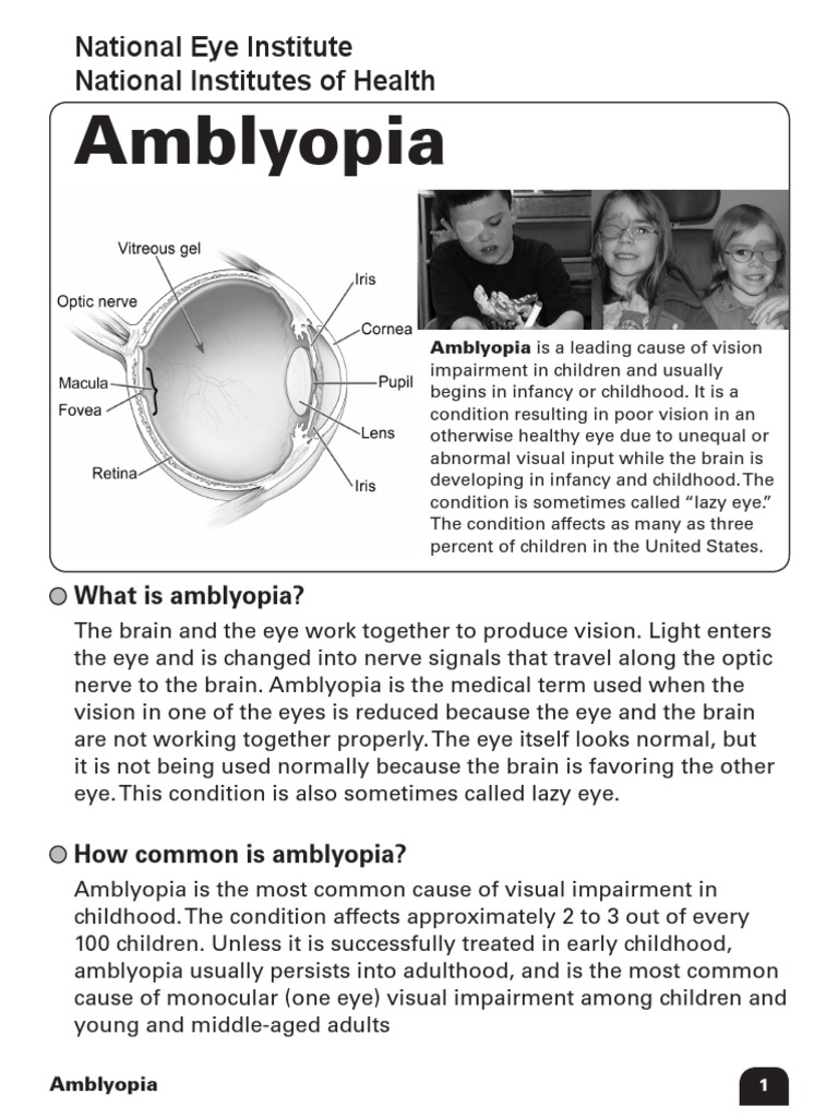 NEI Guide to Amblyopia Causes and Treatments | PDF | Senses | Visual System