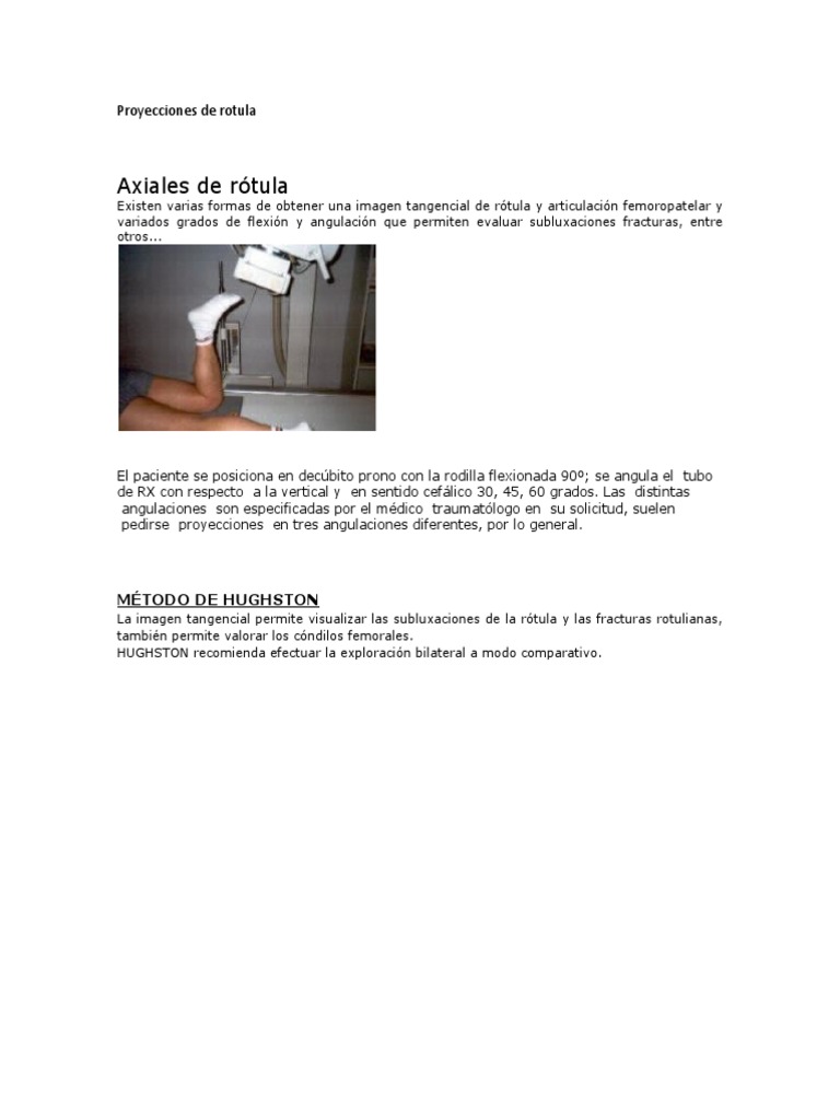 Proyecciones Axiales de Rótula en RX | PDF | Rodilla | Sistema ...
