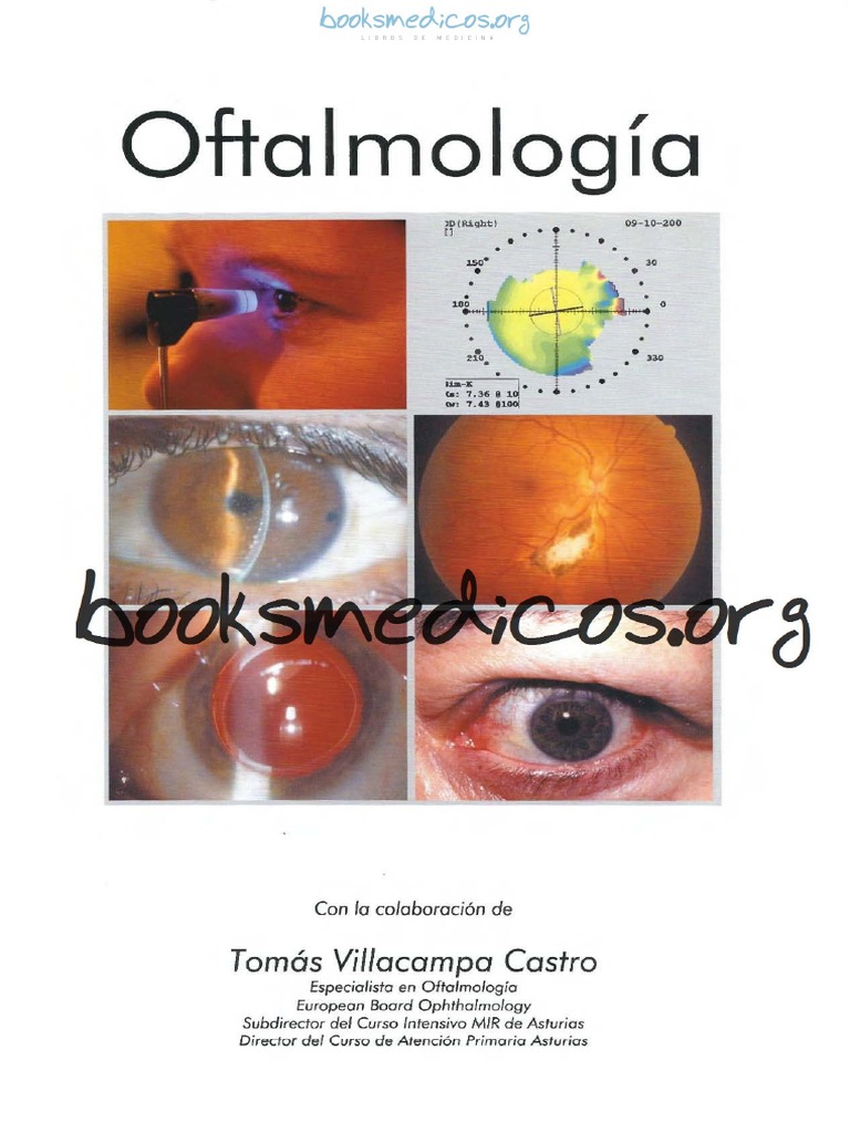 Oftalmologia | PDF | Ojo humano | Epitelio