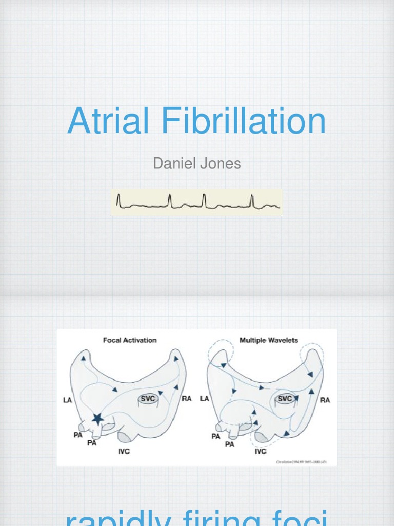 Atrial Fibrillation Overview and Management | PDF | Heart | Internal ...