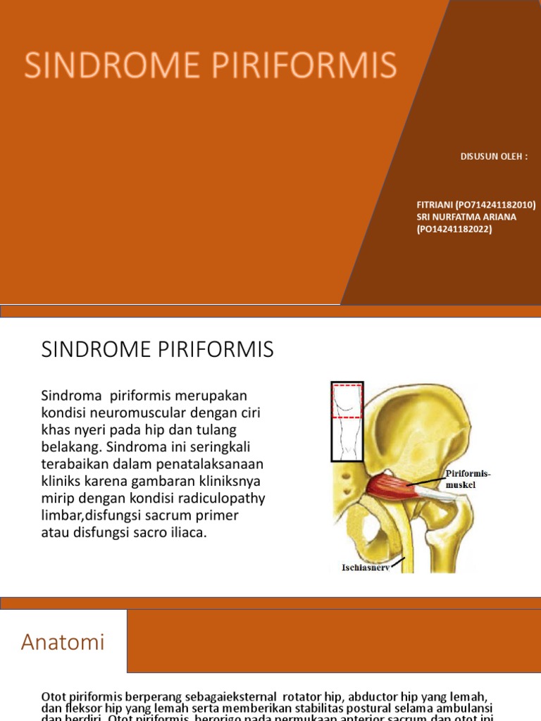 Penanganan Fisioterapi Piriformis | PDF