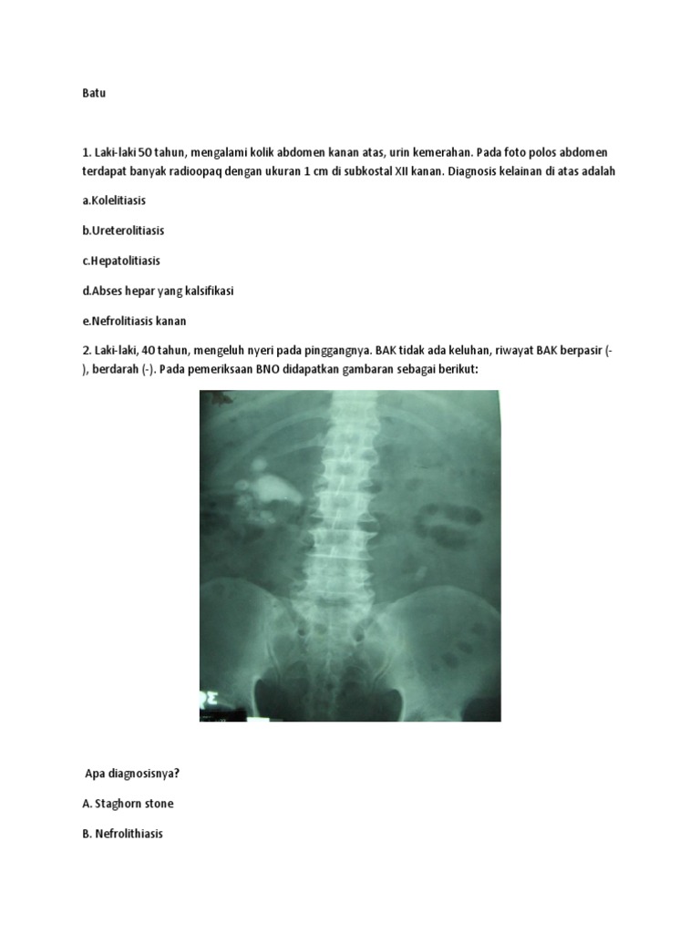 Batu Saluran Kemih | PDF