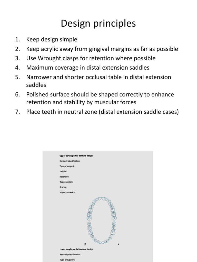 Acrylic Partial Denture Design | PDF