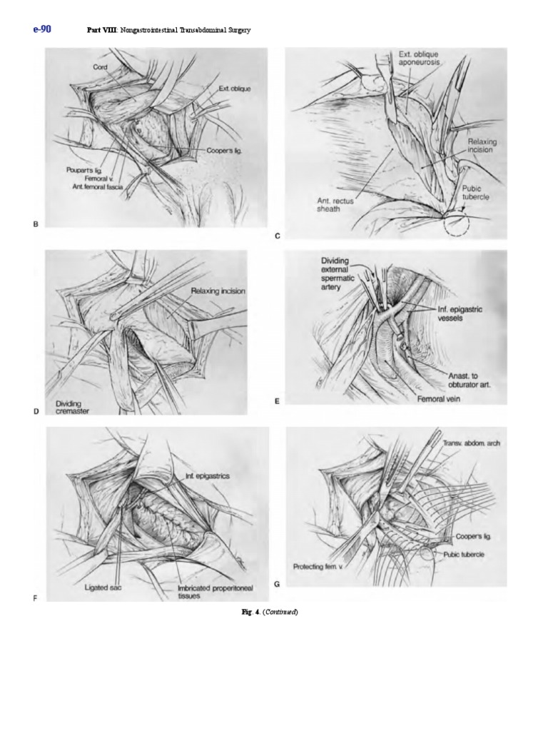 Part VIII: Nongastrointestinal Transabdominal Surgery | PDF