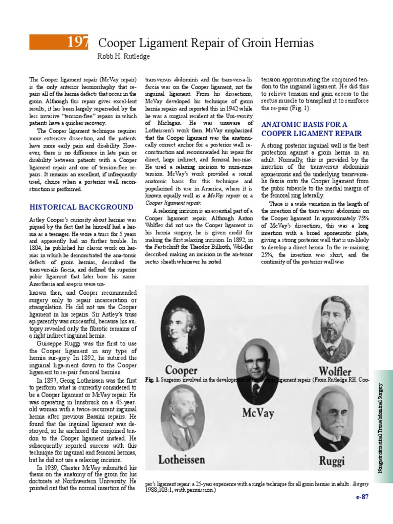 Cooper Ligament Repair of Groin Hernias: Robb H. Rutledge | PDF ...