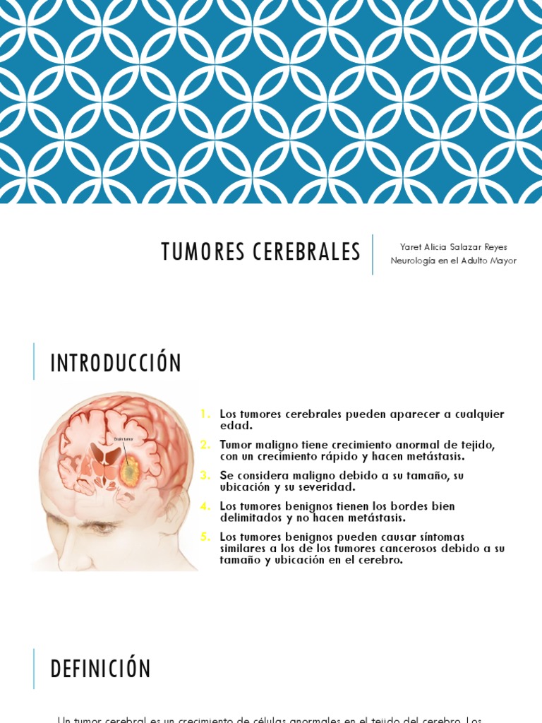 Tumores Cerebrales | PDF | Tumor cerebral | Cáncer