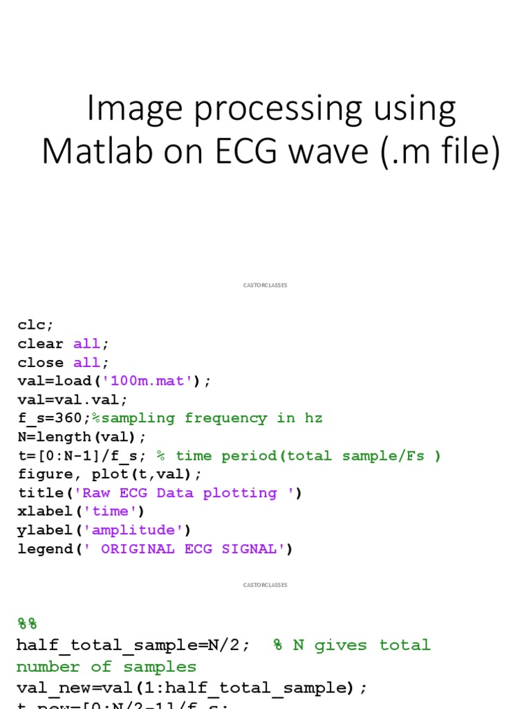 Image Processing of ECG Wave Using Matlab | PDF | Filter (Signal Processing) | Wavelet