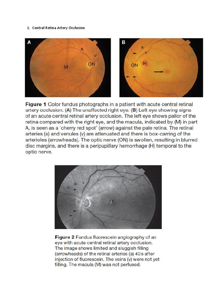 Crao Crvo | PDF | Medical Specialties | Cardiovascular System