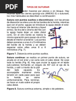 Guía de Sutura Colchonero Horizontal | PDF | Cirugía | Especialidades ...