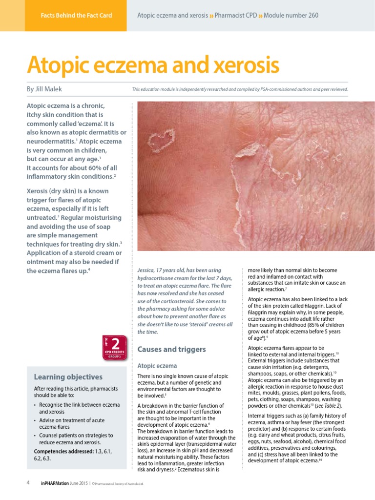 Atopic Eczema and Xerosis | PDF | Dermatitis | Topical Medication