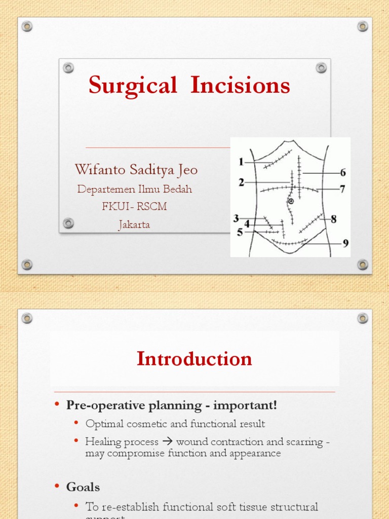 Surgical Incisions | Surgical Suture | Abdomen