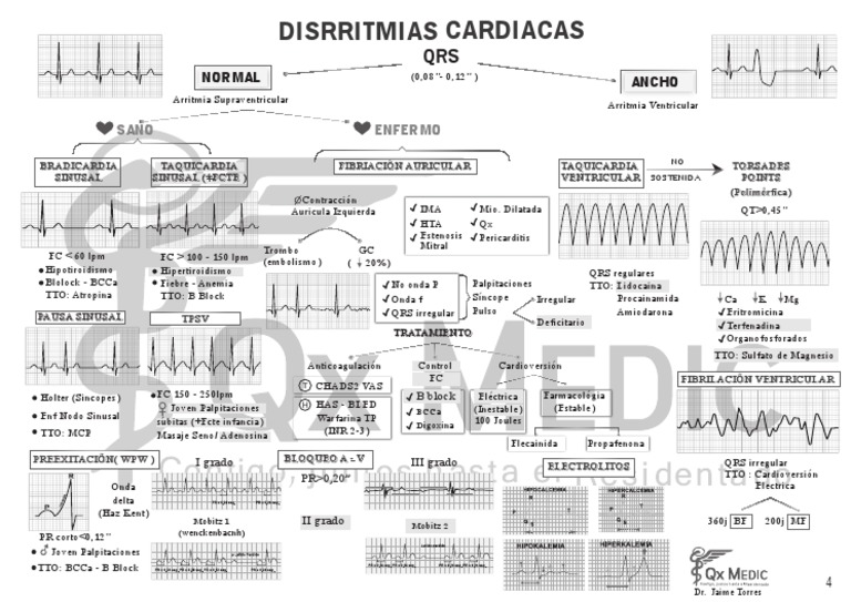 Disrritmias PDF | PDF | Electrofisiologia | Medicina CLINICA