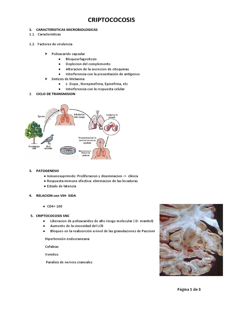 CRIPTOCOCOSIS | PDF | VIH | Especialidades Medicas