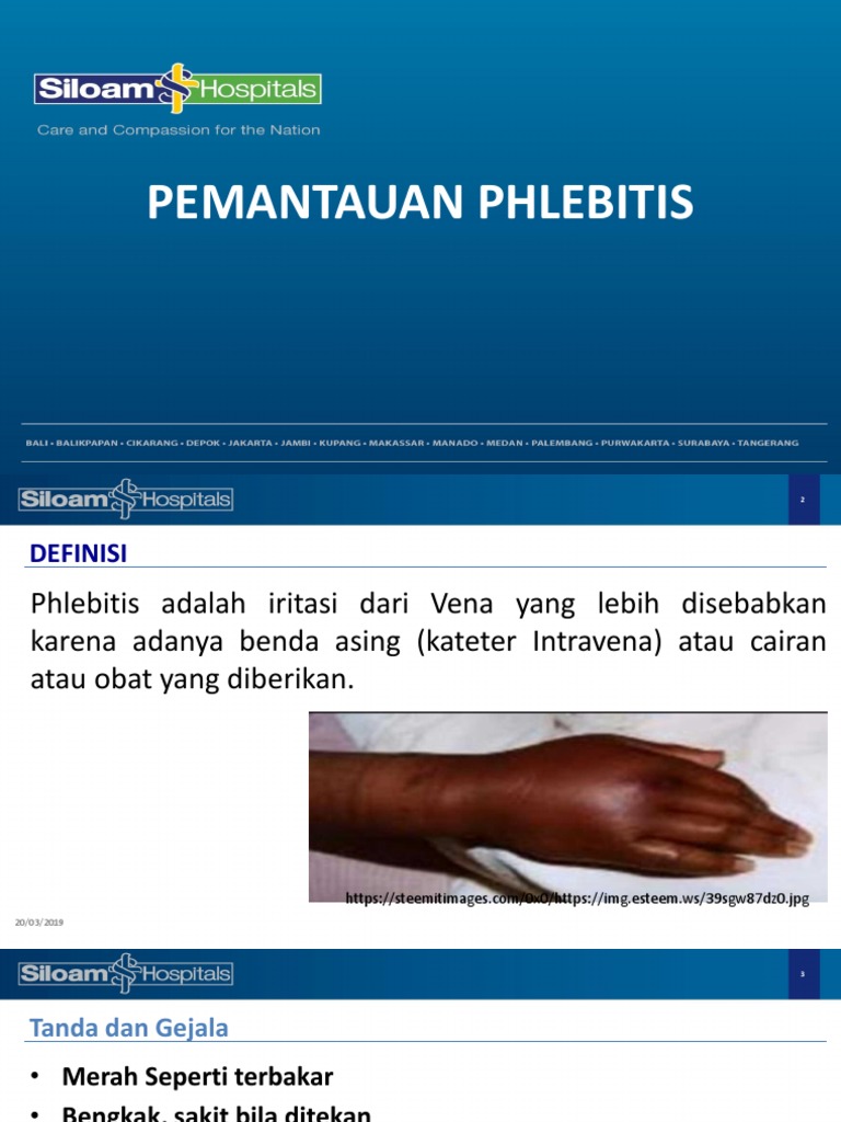 Phlebitis | PDF | Sains & Matematika