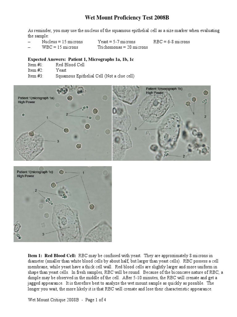 Wet Mount Proficiency Test 2008B: Expected Answers: Patient 1 ...