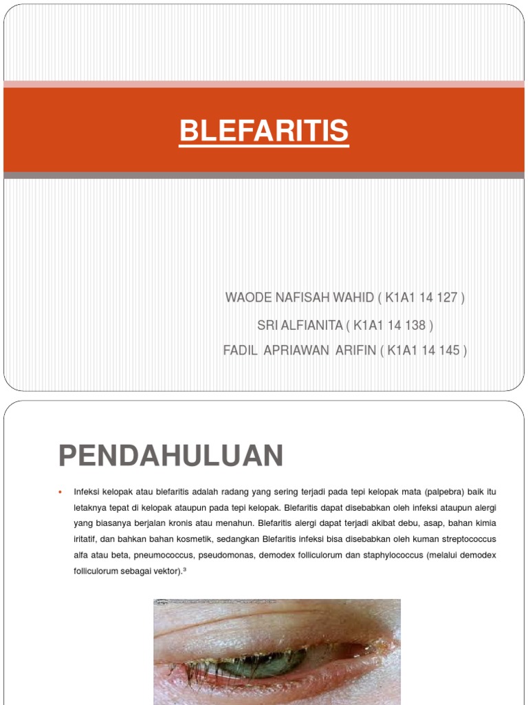 BLEFARITIS | PDF