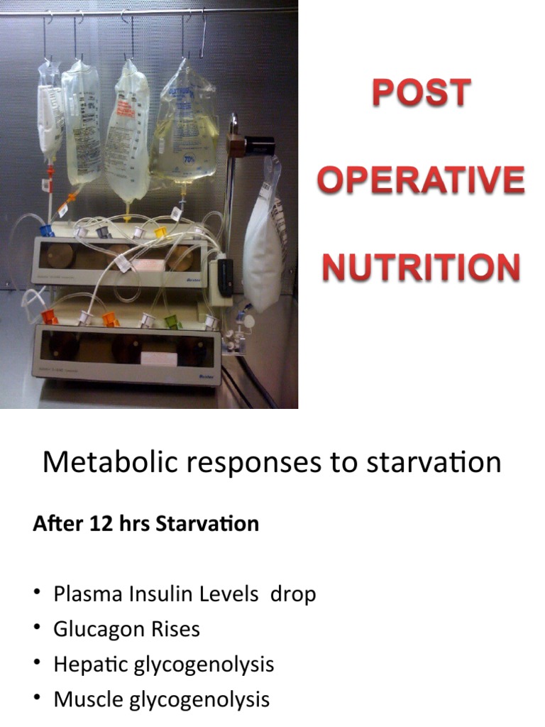 Post Operative Nutrition Basic | PDF | Hyperglycemia | Vitamin