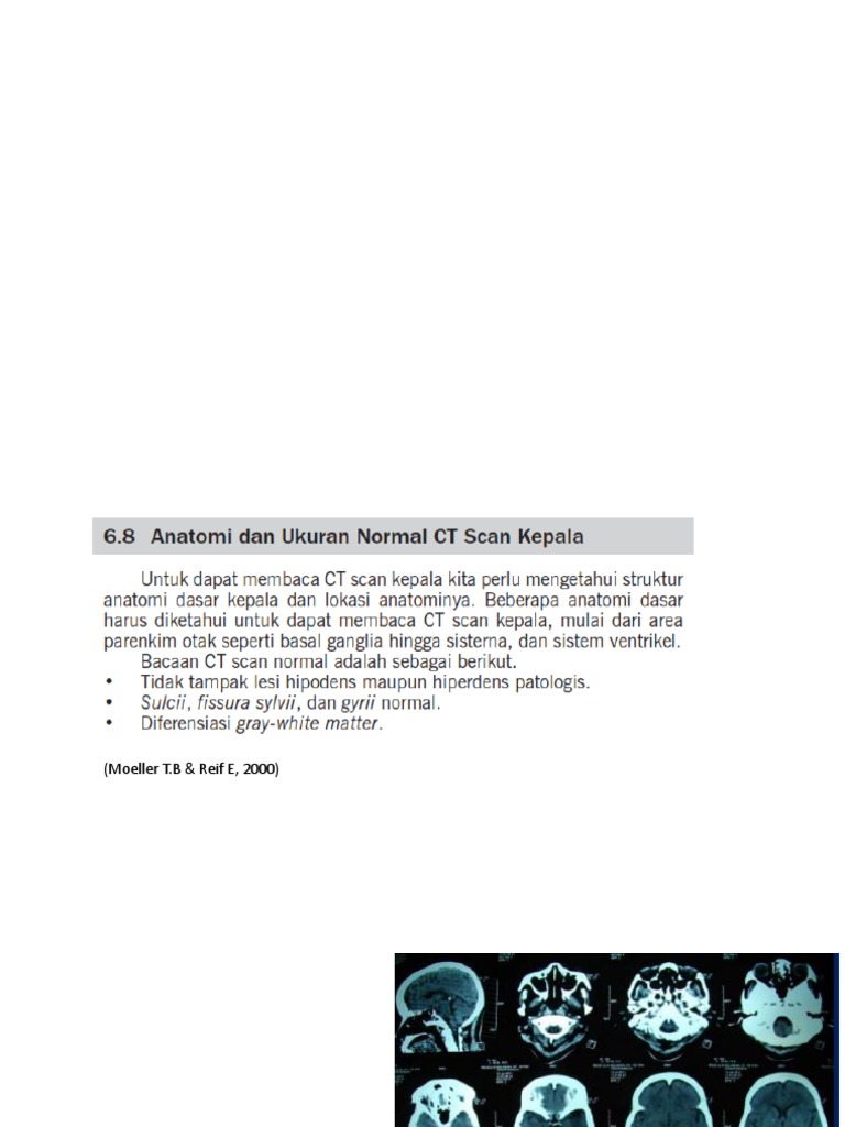 Gambaran Normal CT Scan | PDF | Medical Physics | Medical Imaging