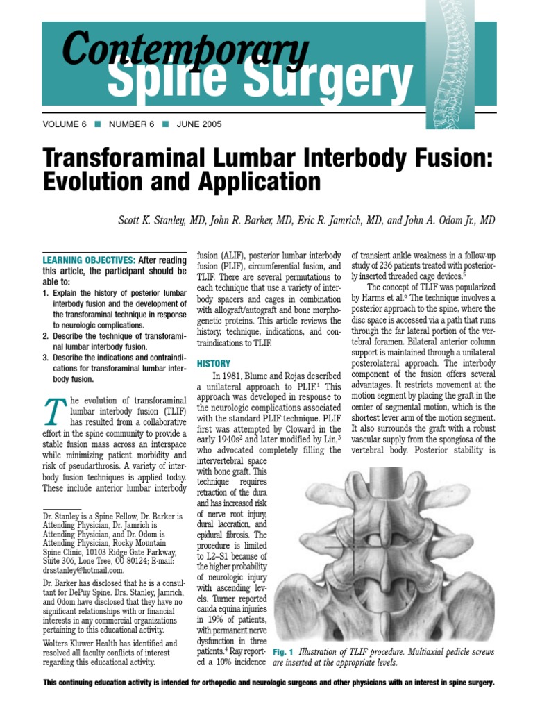 Tlif | PDF | Vertebra | Vertebral Column