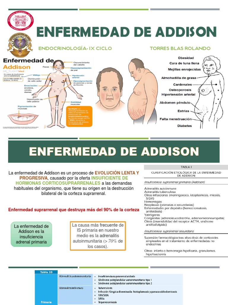 Enfermedad de Addison | PDF | Glándula suprarrenal | Glucocorticoides