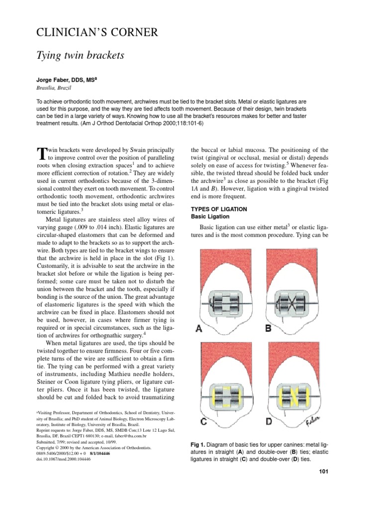 Tying Twin Brackets | PDF | Orthodontics | Dentistry