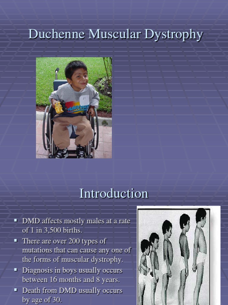 Duchenne Muscular Dystrophy | PDF | Muscular Dystrophy | Physical Therapy