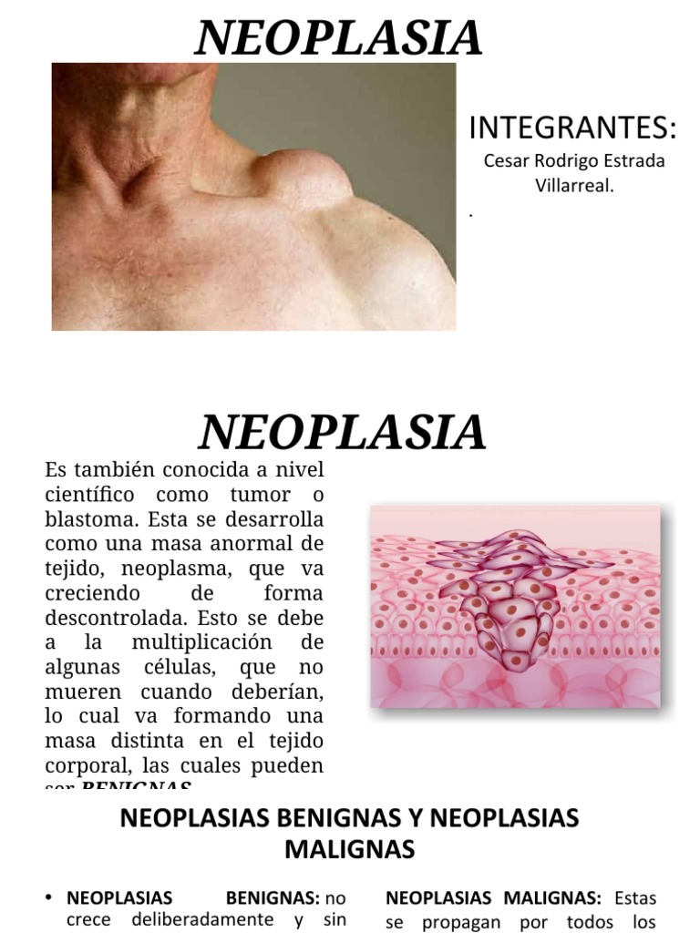 Neo P | PDF | Neoplasias | Cáncer