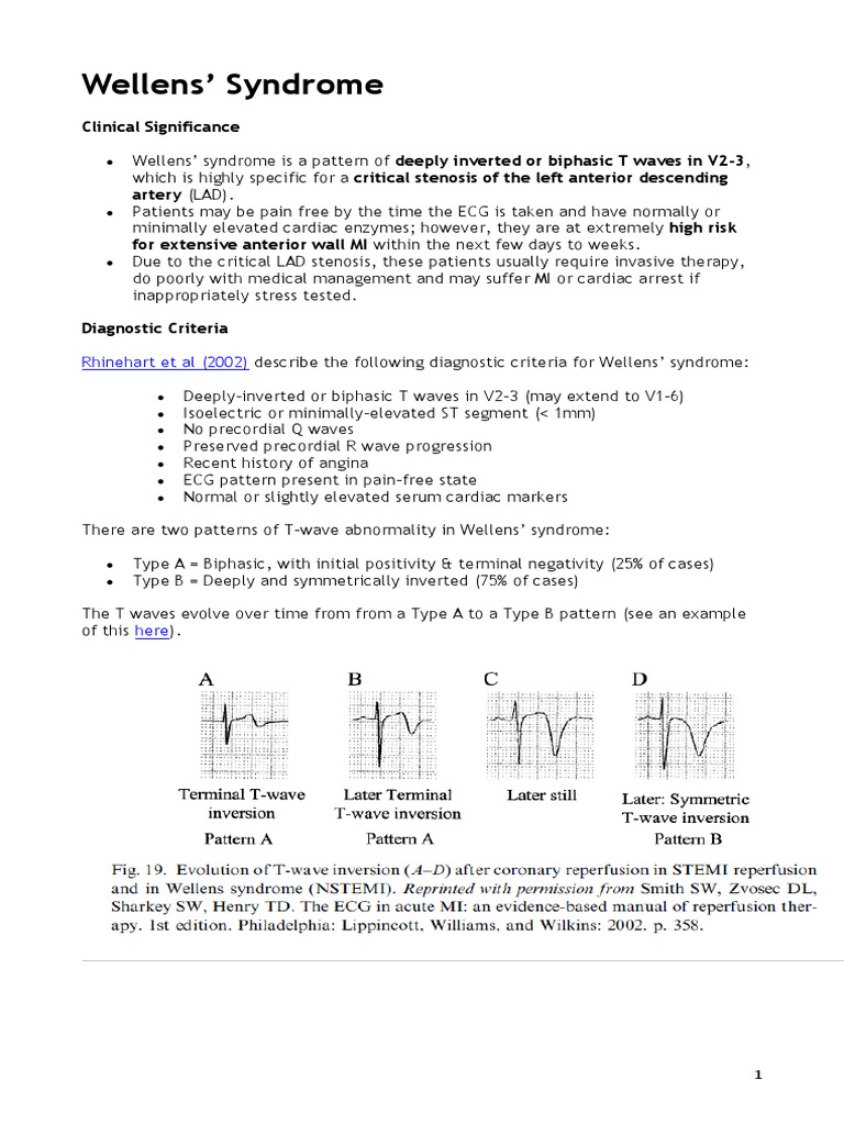 Wellen Ecg | PDF | Electrocardiography | Myocardial Infarction