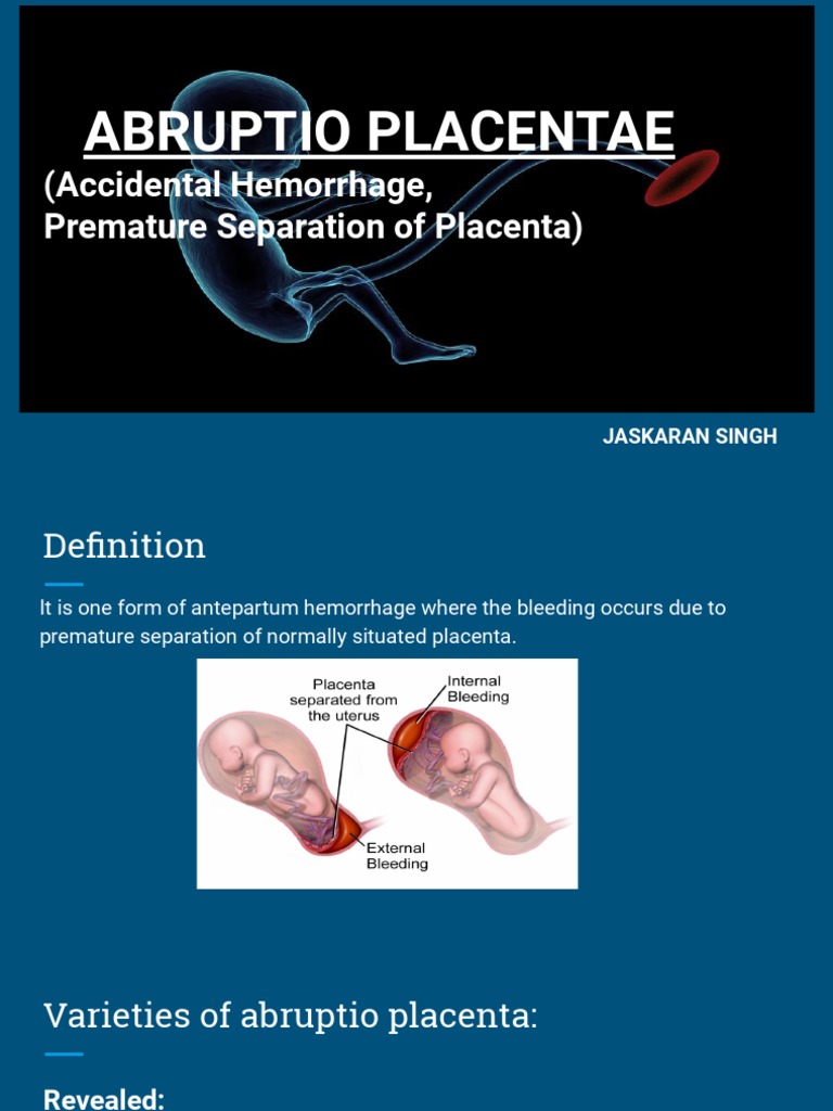 Abruptio Placentae: (Accidental Hemorrhage, Premature Separation of ...