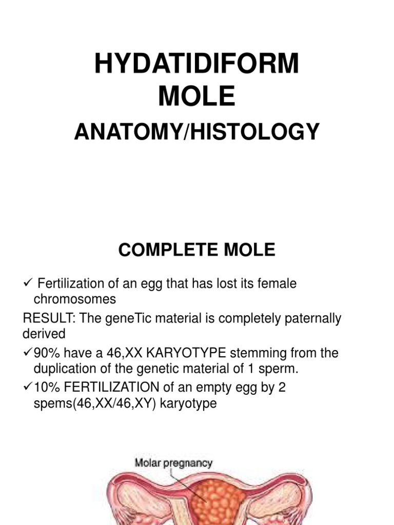 Anatomy of Complete Hydatidiform Mole | PDF | Technology & Engineering
