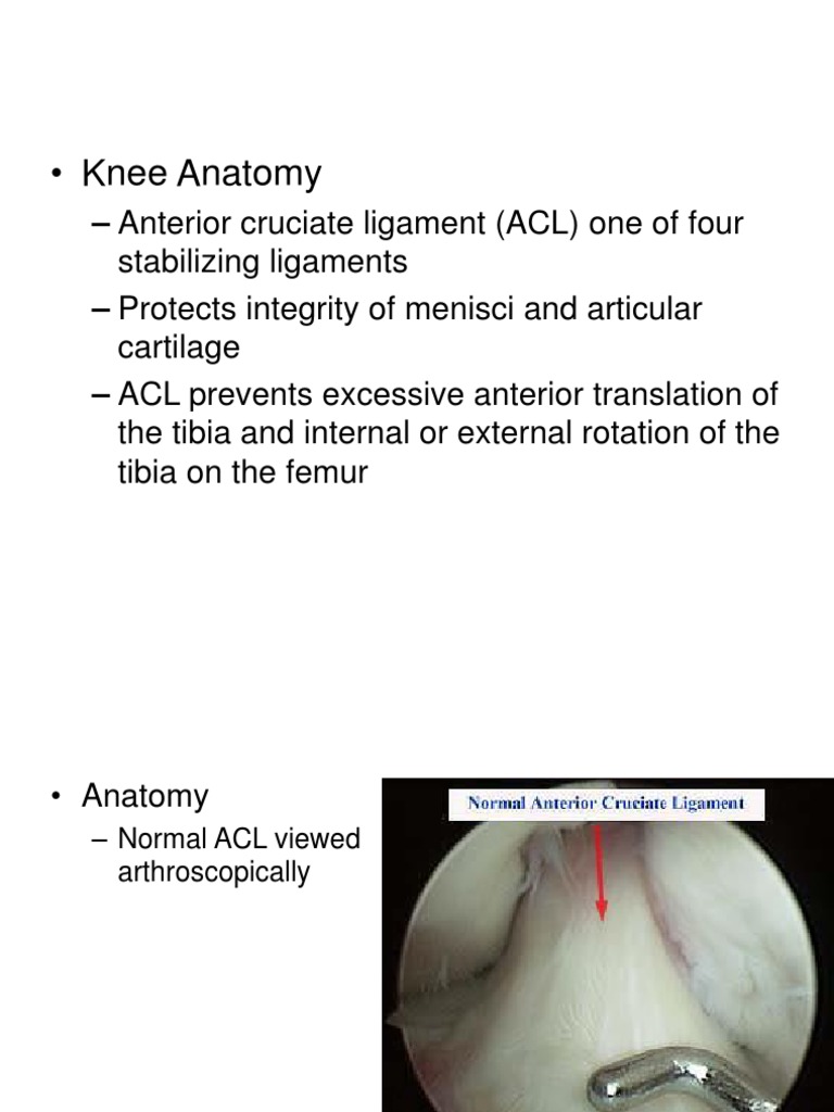 Acl Rupture | PDF | Knee | Musculoskeletal System