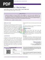 White Without Pressure | PDF | Vision | Ophthalmology