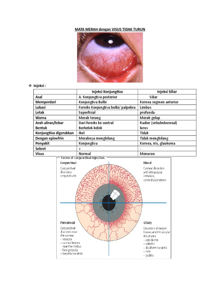 Mata Merah Dengan Visus Tidak Turun | PDF