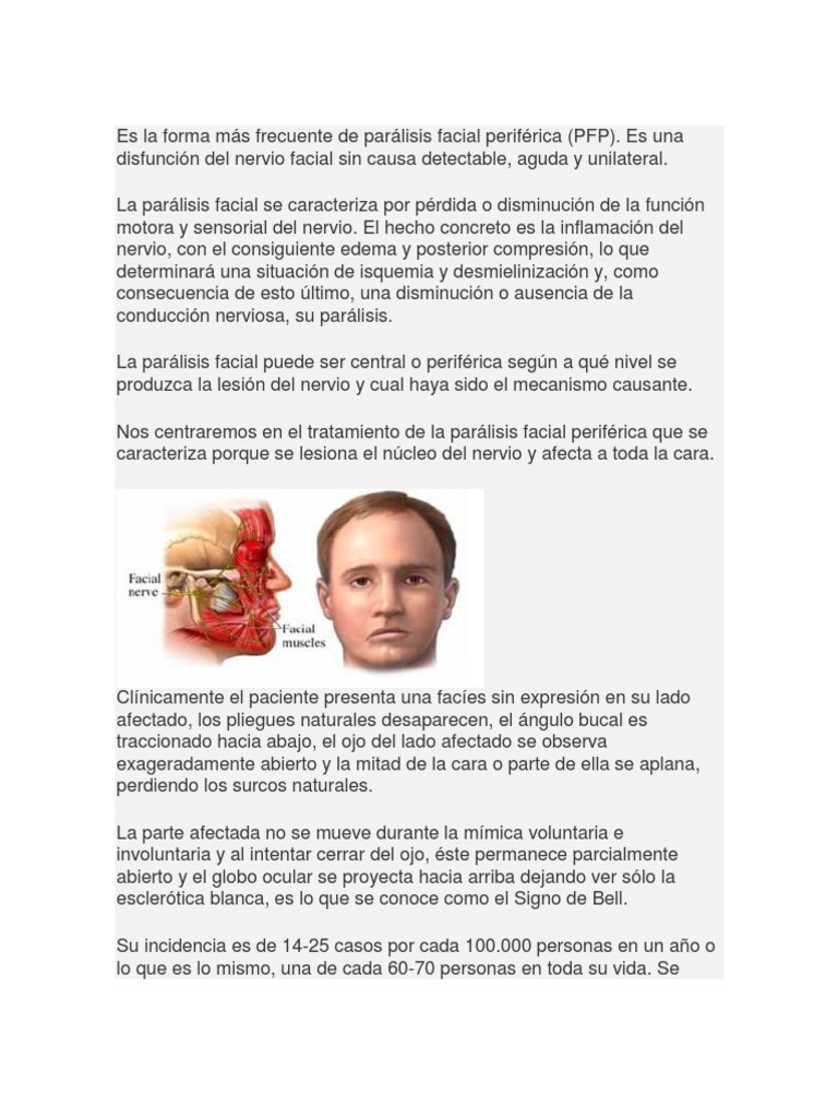 Paralisis De Bell Pdf Medicina Enfermedades Y Trastornos