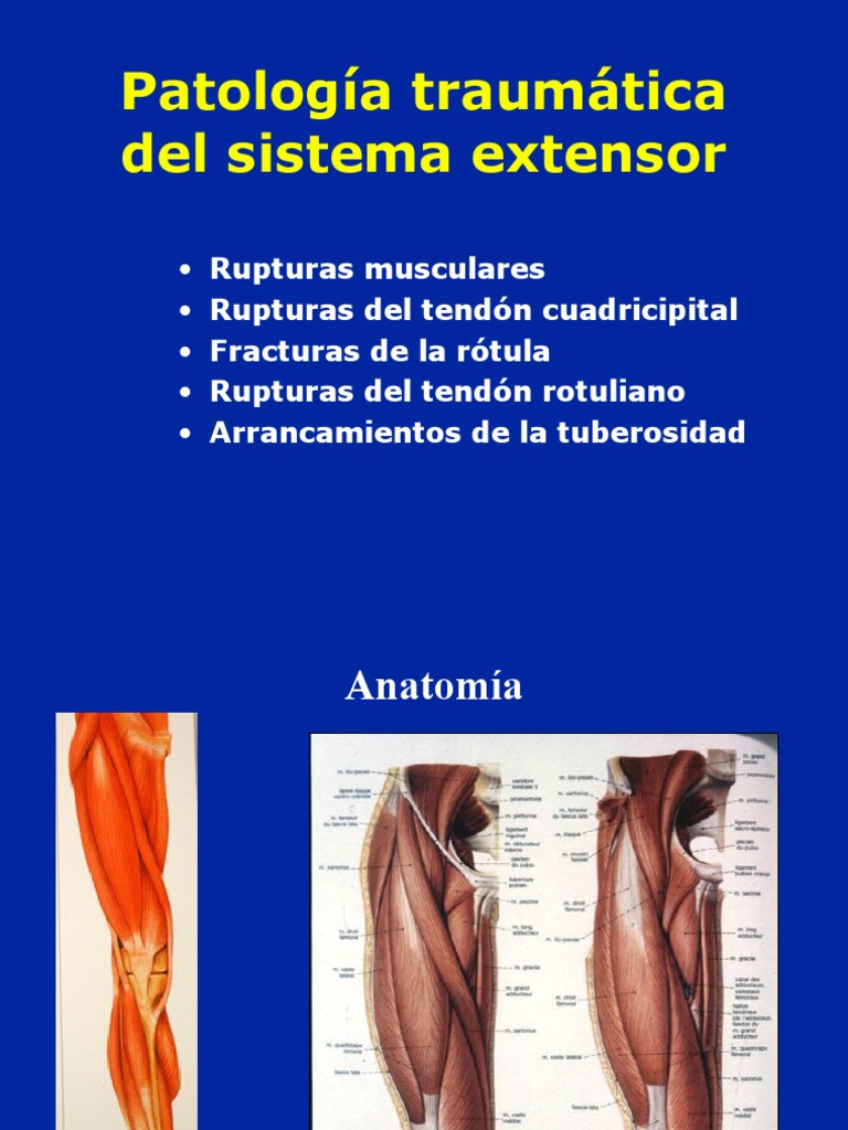 Roturas Del Sistema Extensor | PDF | Rodilla | Sistema musculoesquelético