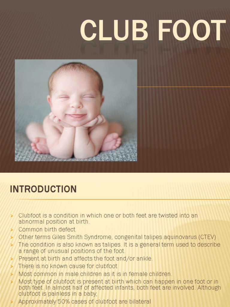 Clubfoot | PDF | Foot | Musculoskeletal System