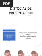 Distocia Funicular: Definición y Evaluación | PDF | Parto | Feto