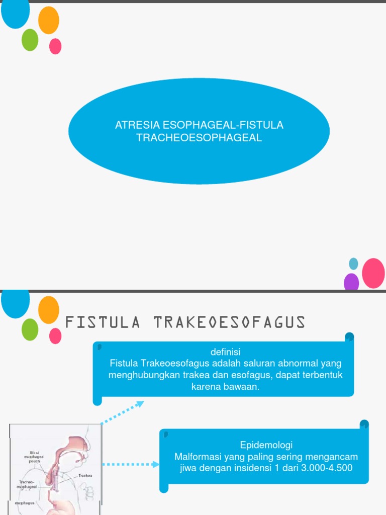 Atresia Esofagus dan Fistula Trakeoesofagus | PDF
