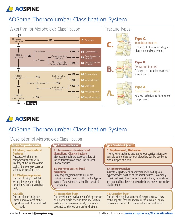 AOSpine Thoracolumbar Classification System - Pocket Card PDF | PDF ...