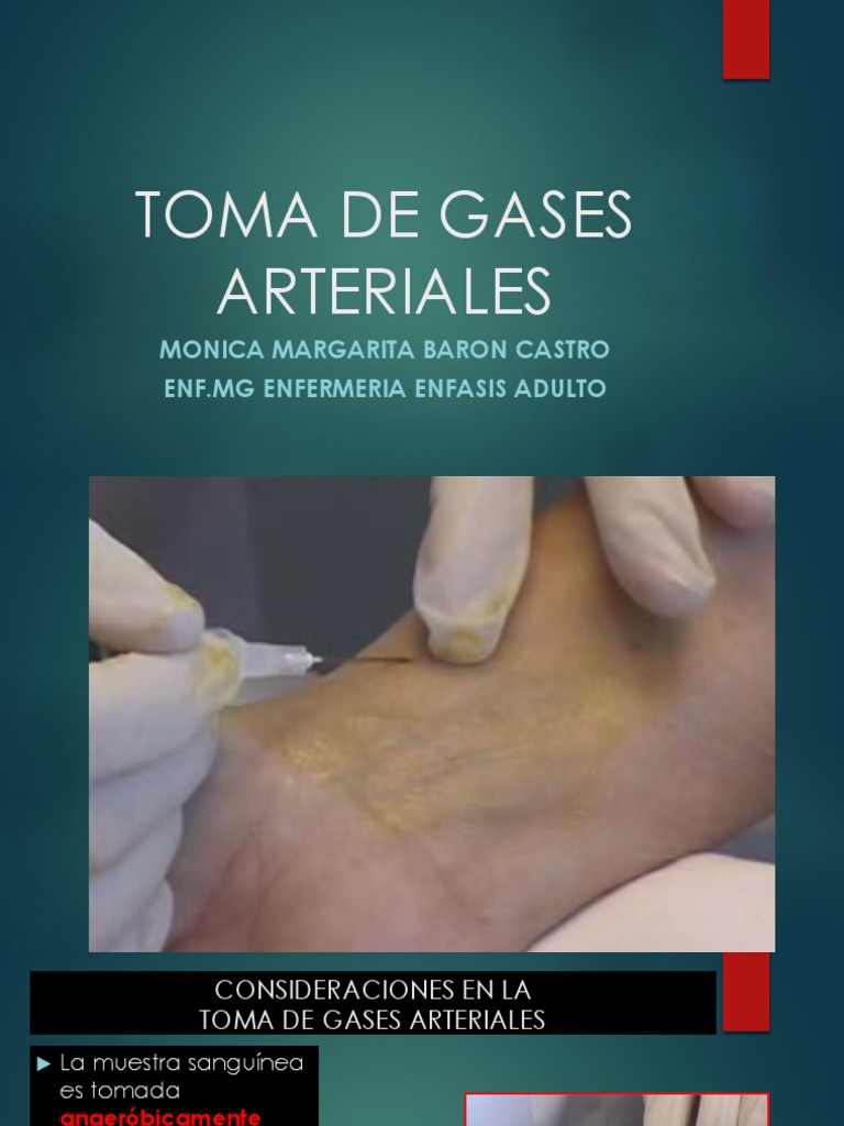 Toma Gases Arteriales | PDF